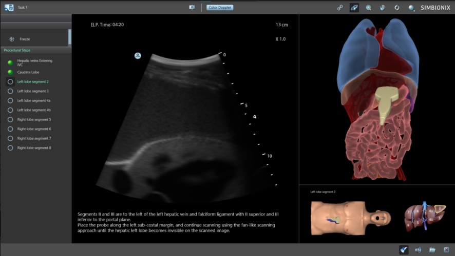 Advanced Abdominal Module - Surgical Science