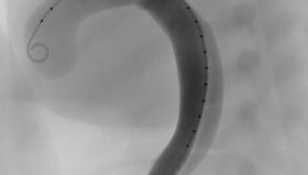 Advanced TEVAR Module - Surgical Science