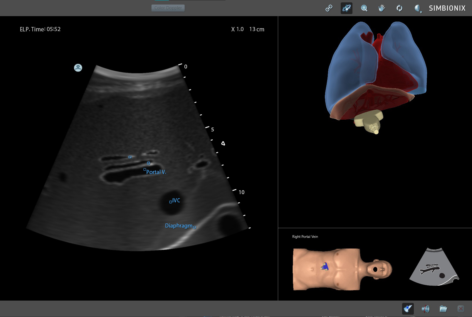 Advanced Abdominal Module - Surgical Science