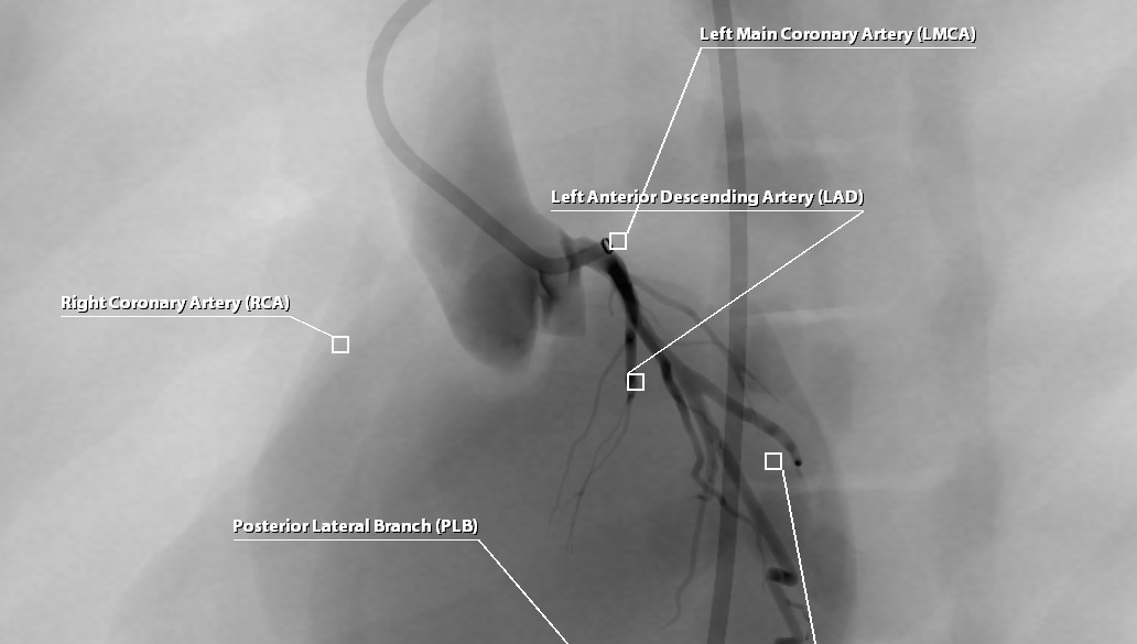 Coronary Intervention Module - Surgical Science