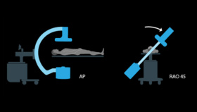 C-arm Basic Skills Module - Surgical Science