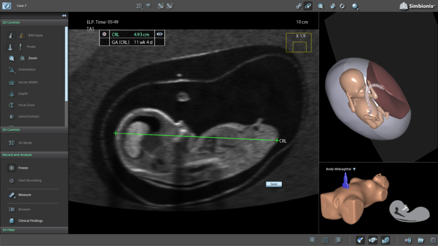 OB 1st Trimester Module - Surgical Science