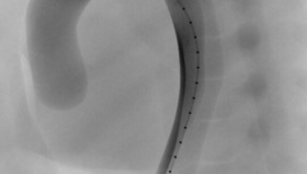 Advanced TEVAR Module - Surgical Science