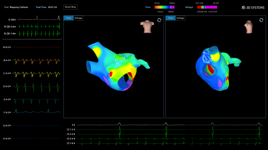 EP Mapping Module - Surgical Science