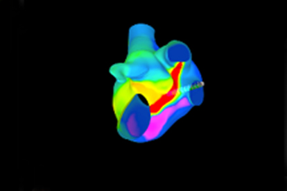 EP Mapping Module - Surgical Science