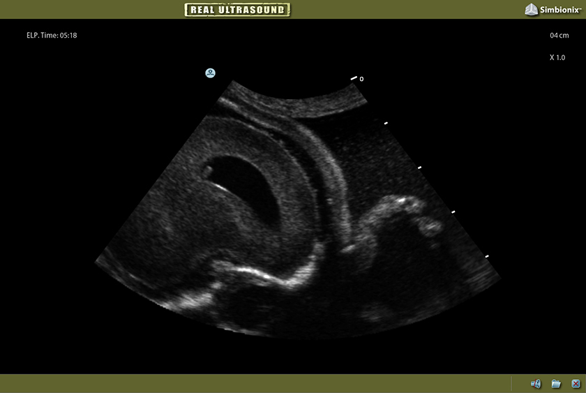 Fetal Neurosonography Module - Surgical Science