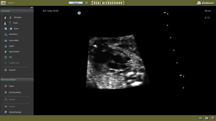 Fetal Echo Module - Surgical Science