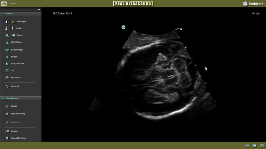 Fetal Neurosonography Module - Surgical Science
