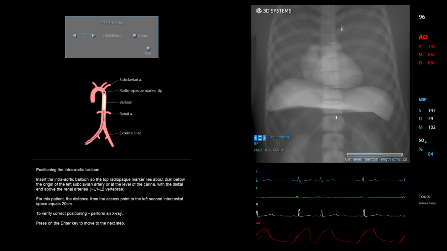 Bedside Cardiac ICU Module - Surgical Science