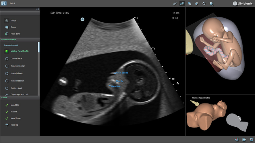 OB 2nd Trimester Module - Surgical Science