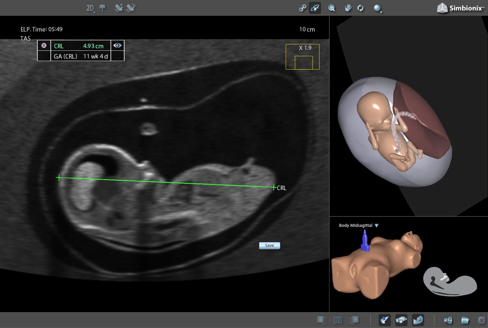 OB 1st Trimester Module - Surgical Science