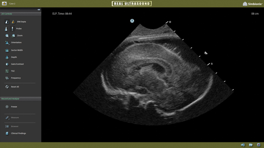 Fetal Neurosonography Module - Surgical Science