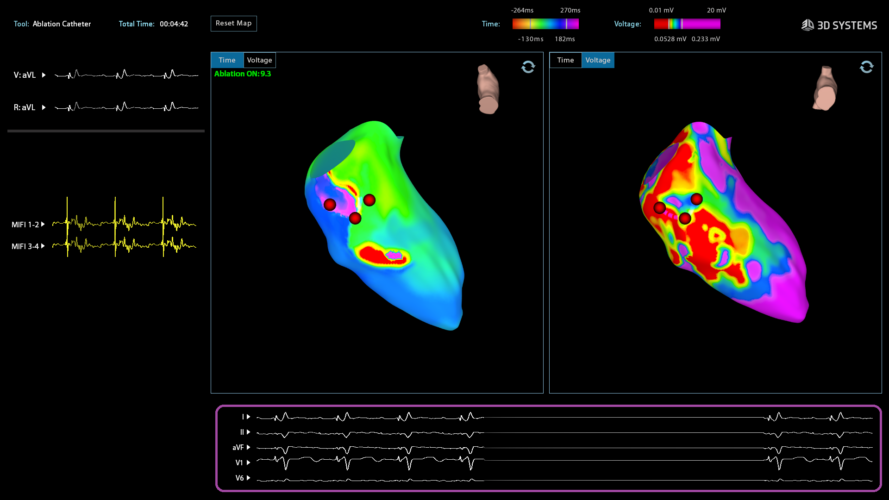 EP Mapping Module - Surgical Science