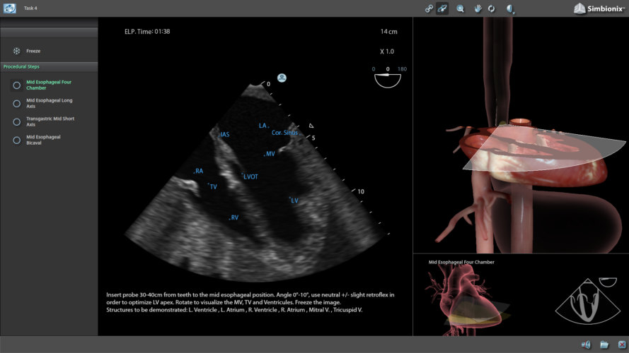TEE Emergency Module - Surgical Science