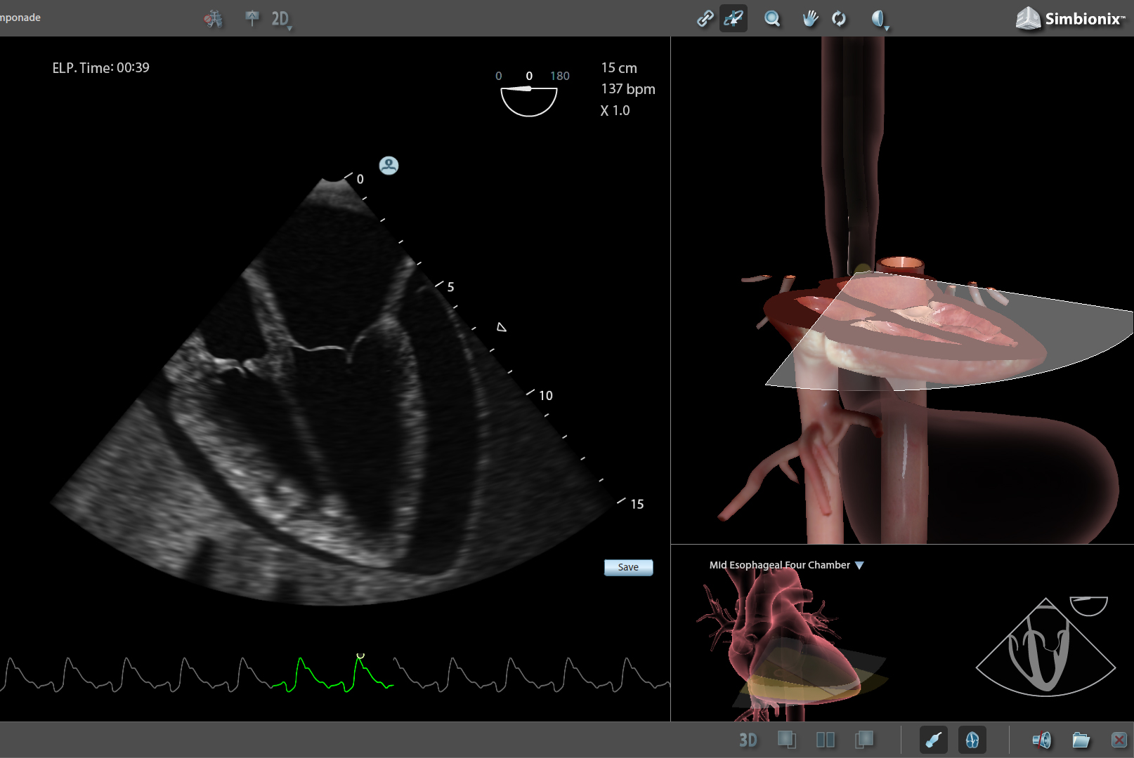 TEE Emergency Module - Surgical Science