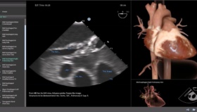 TEE Express - TEE Module - Surgical Science