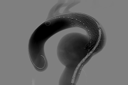 TEVAR Module - Surgical Science