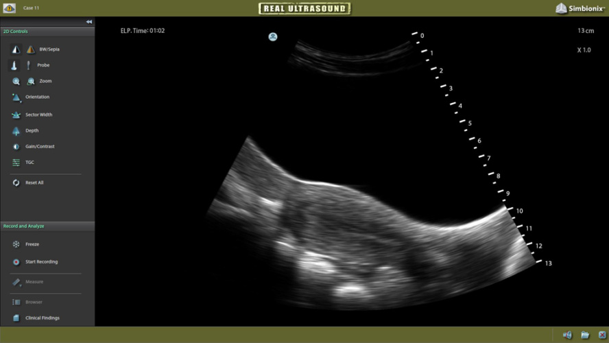 Basic GYN Module - Surgical Science