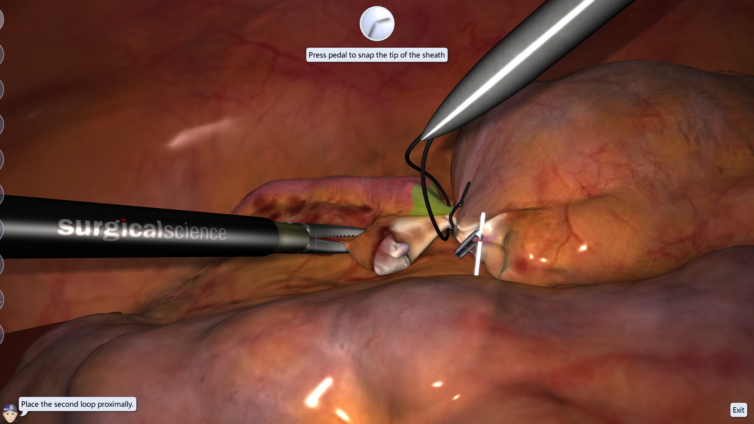 Appendectomy Module Surgical Science Appendectomy Module Surgical Science