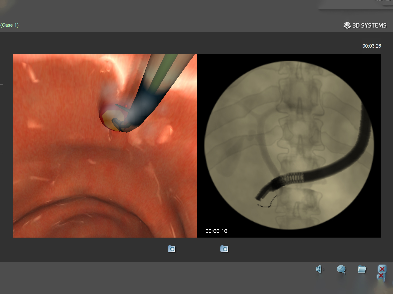 ERCP Module - Surgical Science