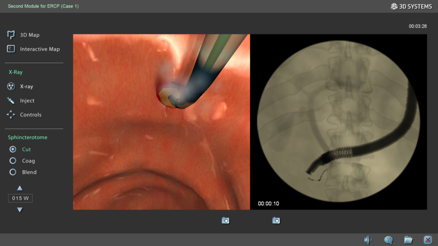 ERCP Module - Surgical Science