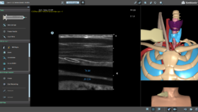 Central Line Ultrasound Module - Surgical Science