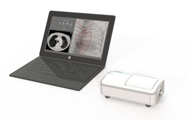 ANGIO Mentor Platforms - Surgical Science