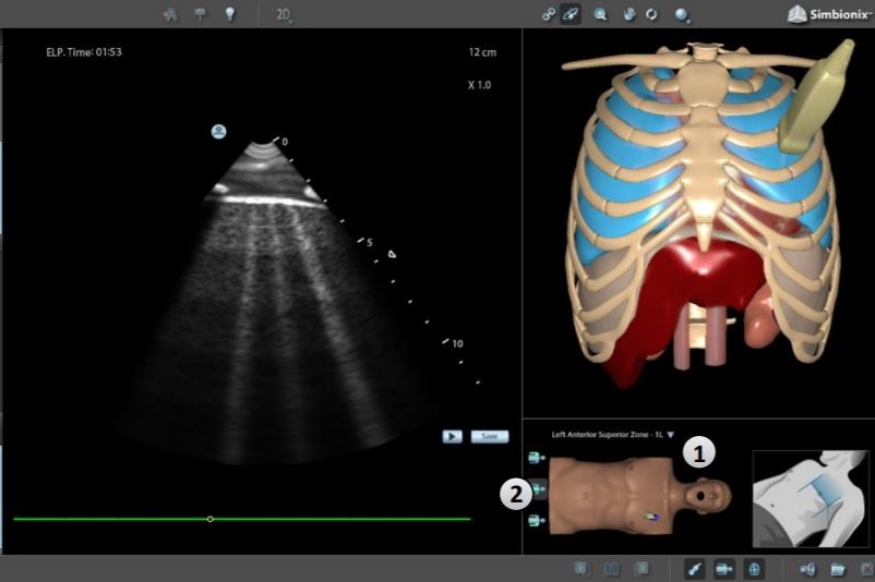 Ultrasound Mentor - Surgical Science