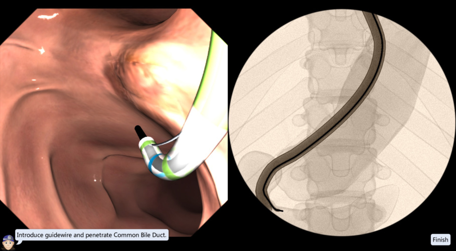 Ercp Module Surgical Science