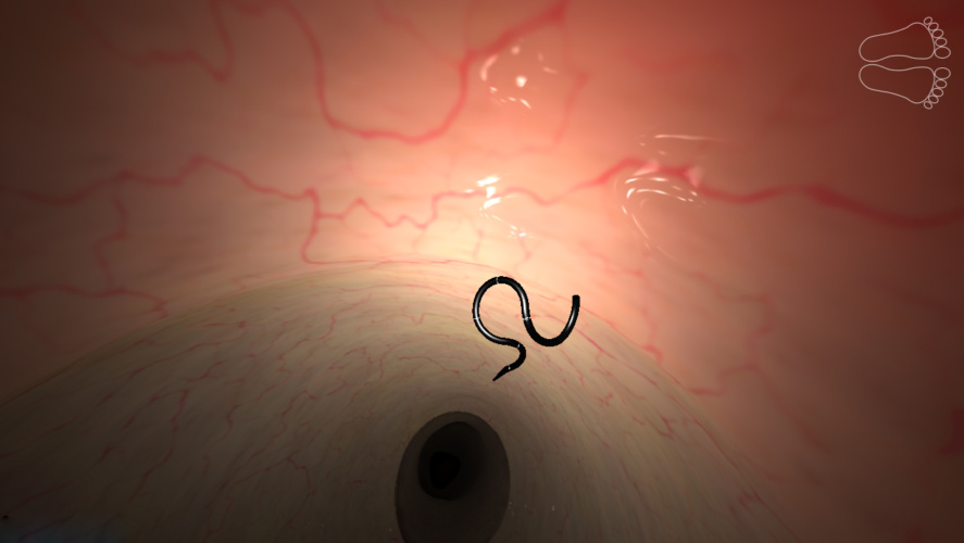 Lower GI Module - Surgical Science