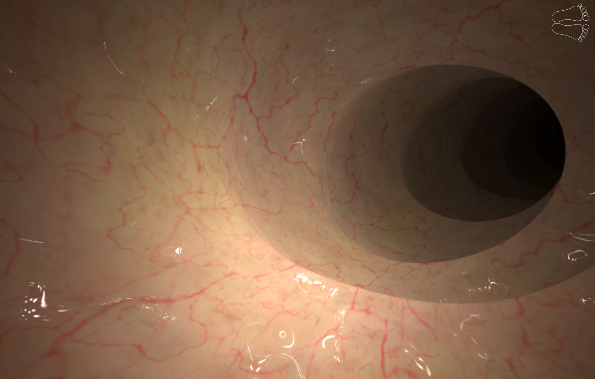 Lower GI Module - Surgical Science