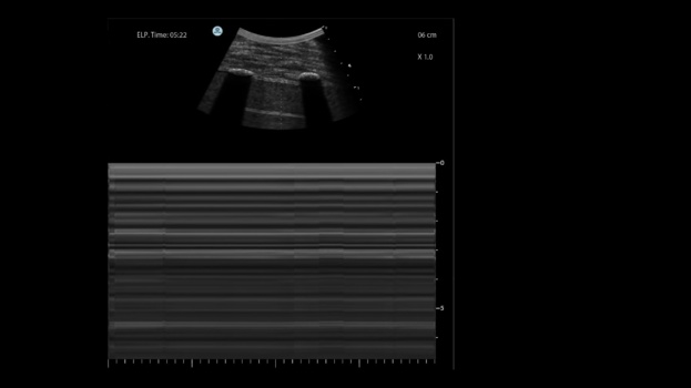 eFAST and RUSH Module - Surgical Science