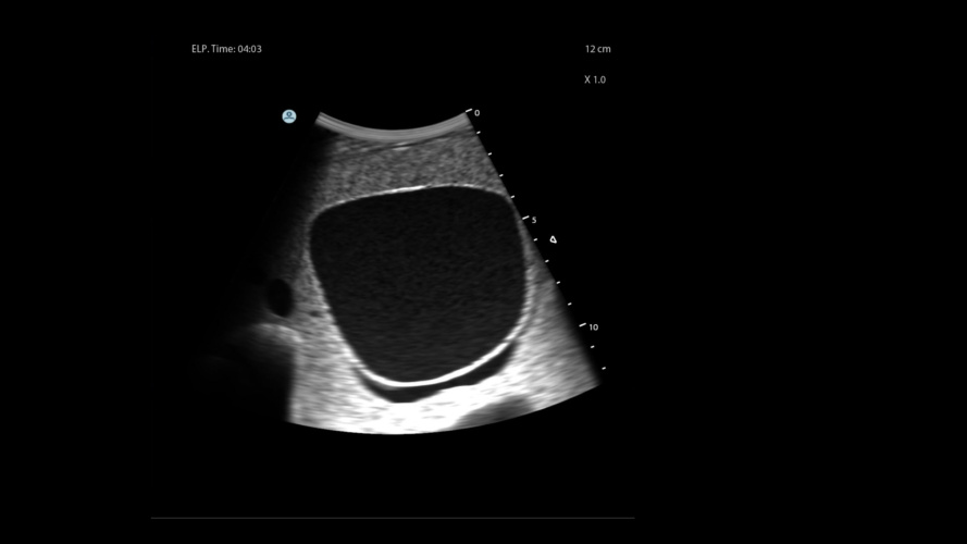 eFAST and RUSH Module - Surgical Science