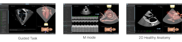 New Pediatric Advanced Echo Module Coming Soon - Surgical Science