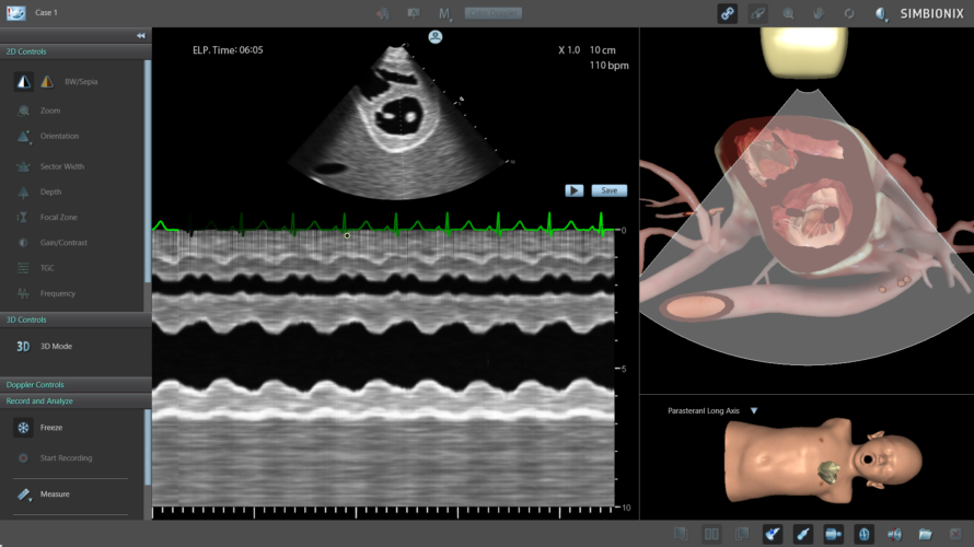 Pediatric Advanced Echo Module - Surgical Science