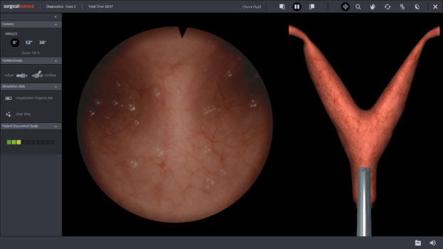 Diagnostic Hysteroscopy - Surgical Science