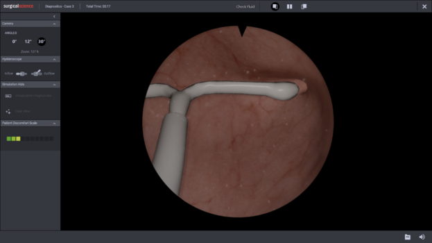Diagnostic Hysteroscopy - Surgical Science
